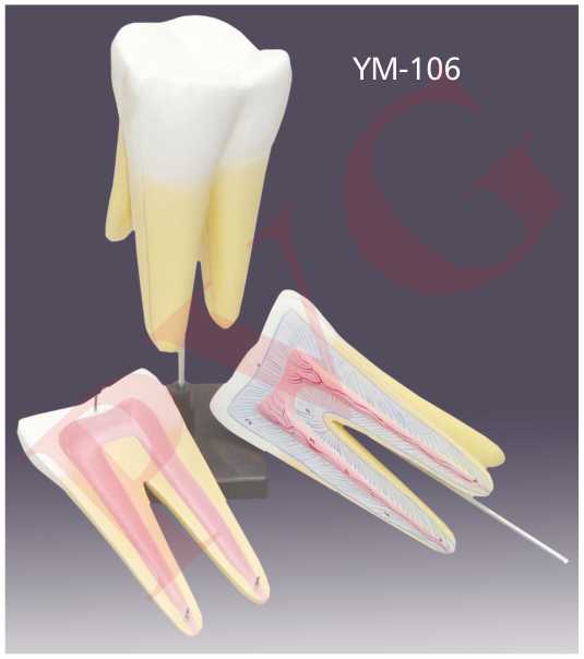 YM-106 MODEL OF GIANT MOLAR – PVG INTERNATIONAL